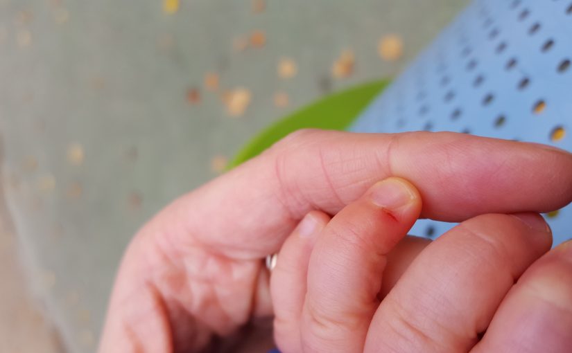 Une coupure au doigt de bébé Archives - Mes chers enfants